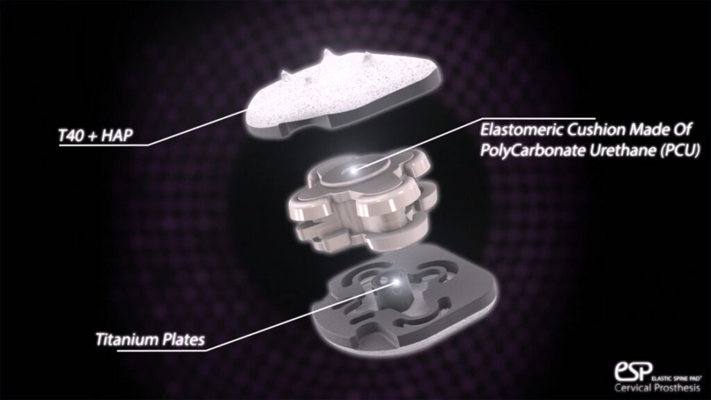3D Animation ESP FH ORTHOPEDICS - SYNTHES3D
